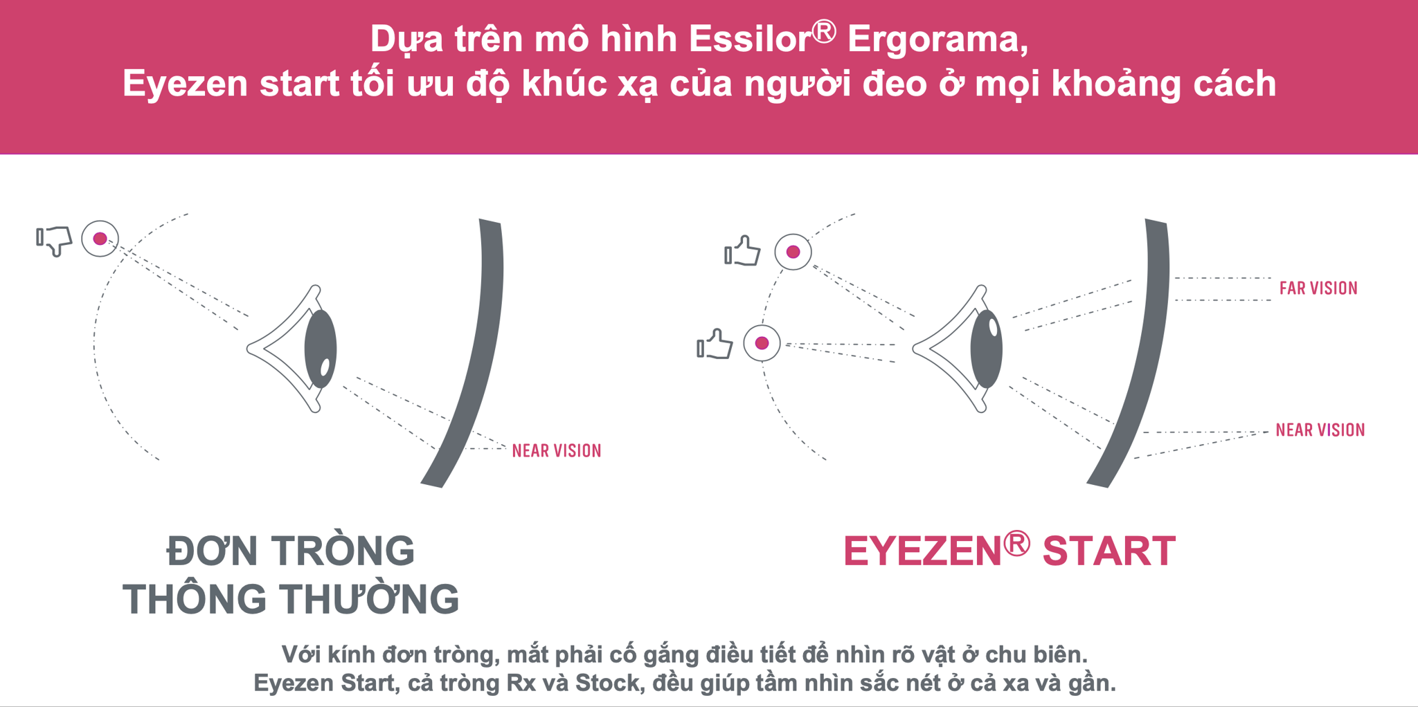 Tròng kính Eyezen – EnY OPTOMETRY VN