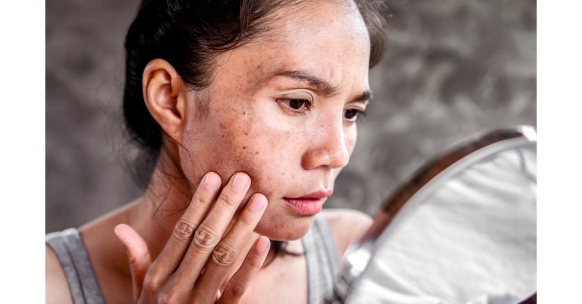 15+ cách dưỡng trắng da mặt từ tự nhiên đến chuyên sâu