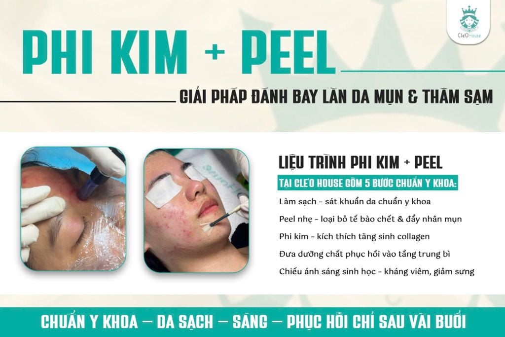 Phi Kim + Peel – Giải Pháp Đánh Bay Làn Da Mụn & Thâm Sạm – CLEOHOUSE