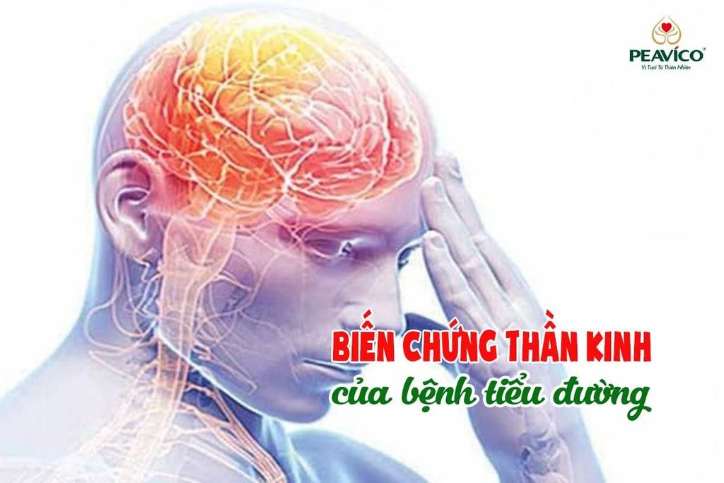 Biến Chứng Thần Kinh Của Bệnh Tiểu Đường & Giải Pháp Phục Hồi Tự Nhiên ...