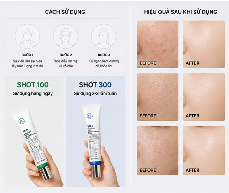 (NHẬP KHẨU-X.DƯƠNG) Tinh chất dưỡng da PrettySkin Exosome Ionic Bright ...