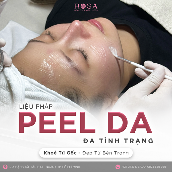 PEEL Da Đa Tình Trạng (Chemical Peel) – Rosa Beauty and Wellness